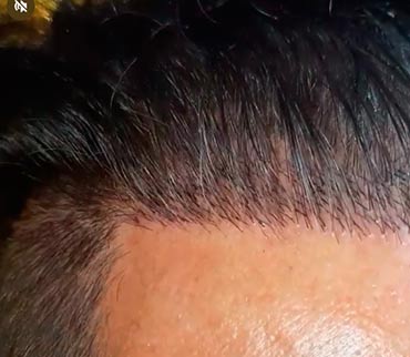 MyriaMaidana - #micropigmentaciónyestetica #microblading